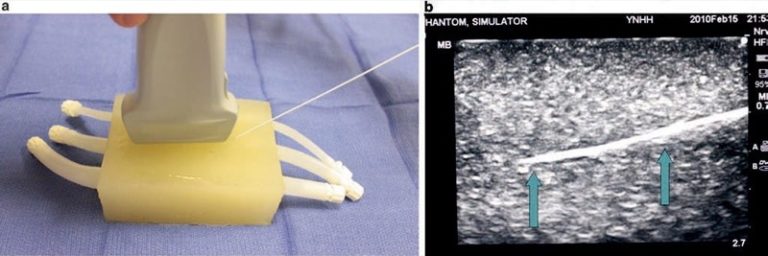 Ultrasound Technical Aspects: How to Improve Needle Visibility - NYSORA