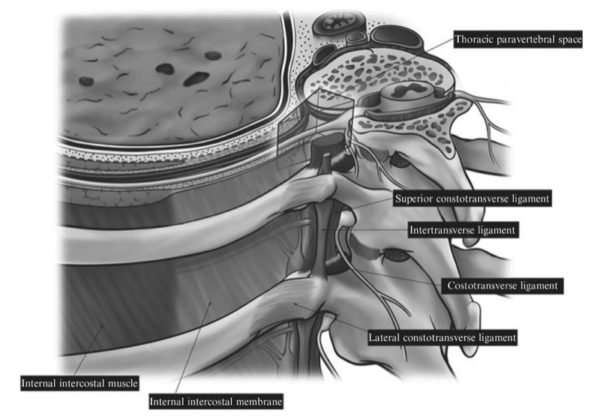 Ultrasound-Guided Thoracic Paravertebral Block - NYSORA