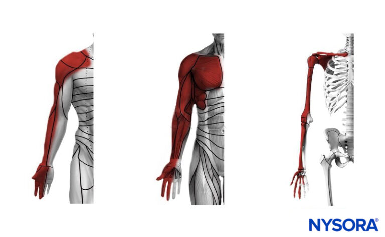 Ultrasound-Guided Upper Extremity Blocks - NYSORA