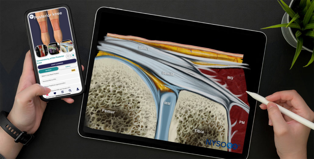 NYSORA MSK Ultrasound Knee App - NYSORA