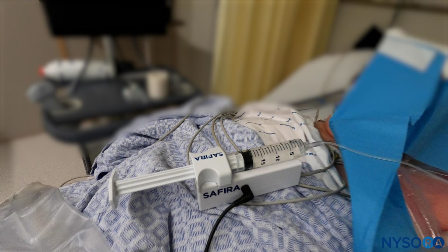 Single Operator Nerve Blocks - NYSORA