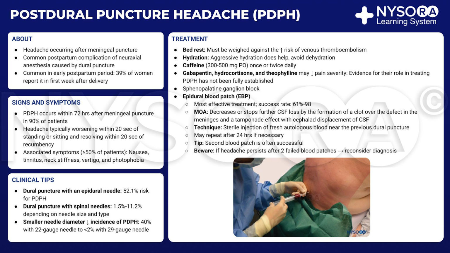 Epidural Blood Patch: How To - NYSORA