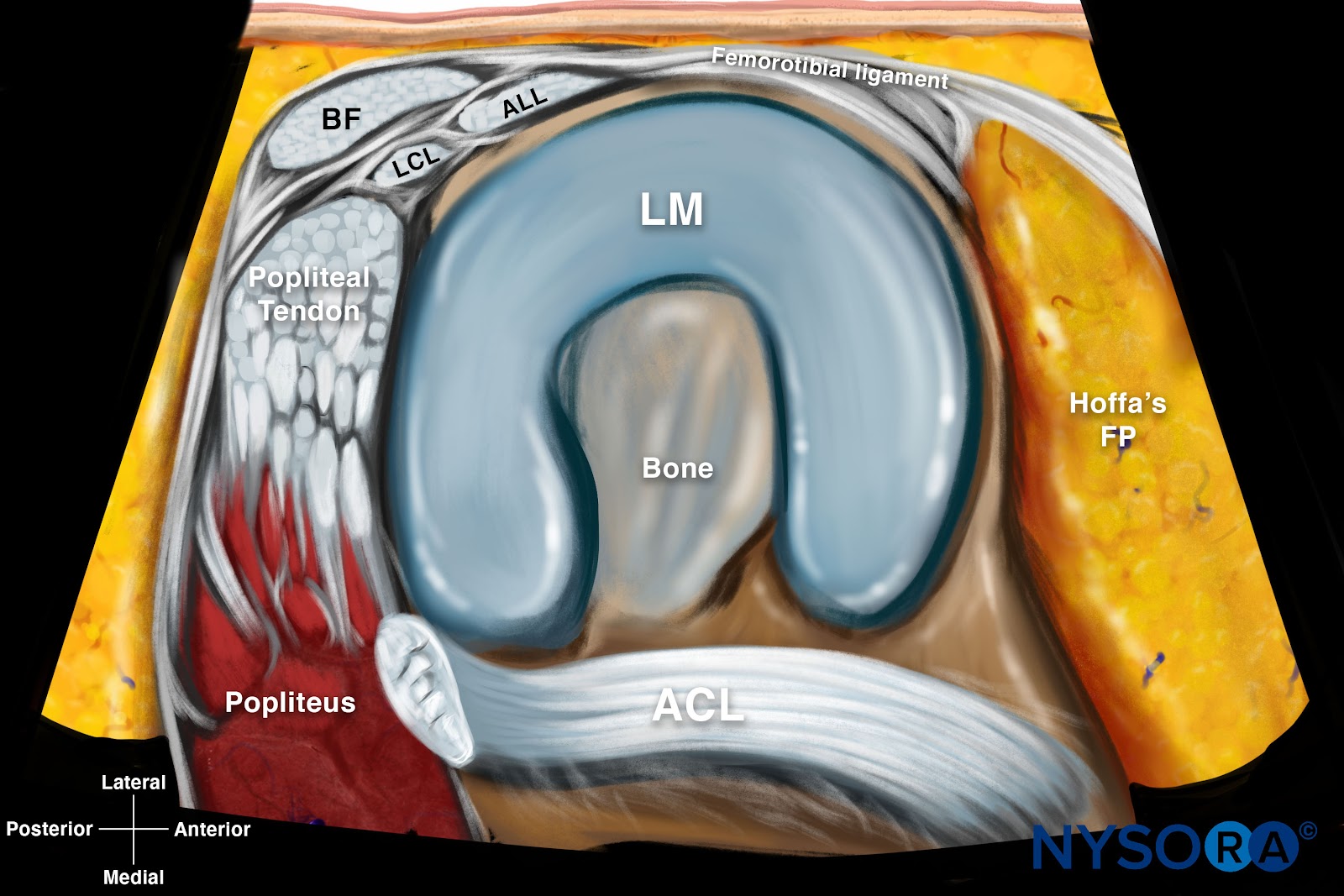 MSK Tip of the Week for Scanning the Lateral Meniscus in a Transverse ...
