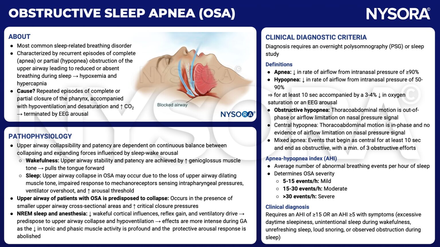 Obstructive sleep apnea - NYSORA