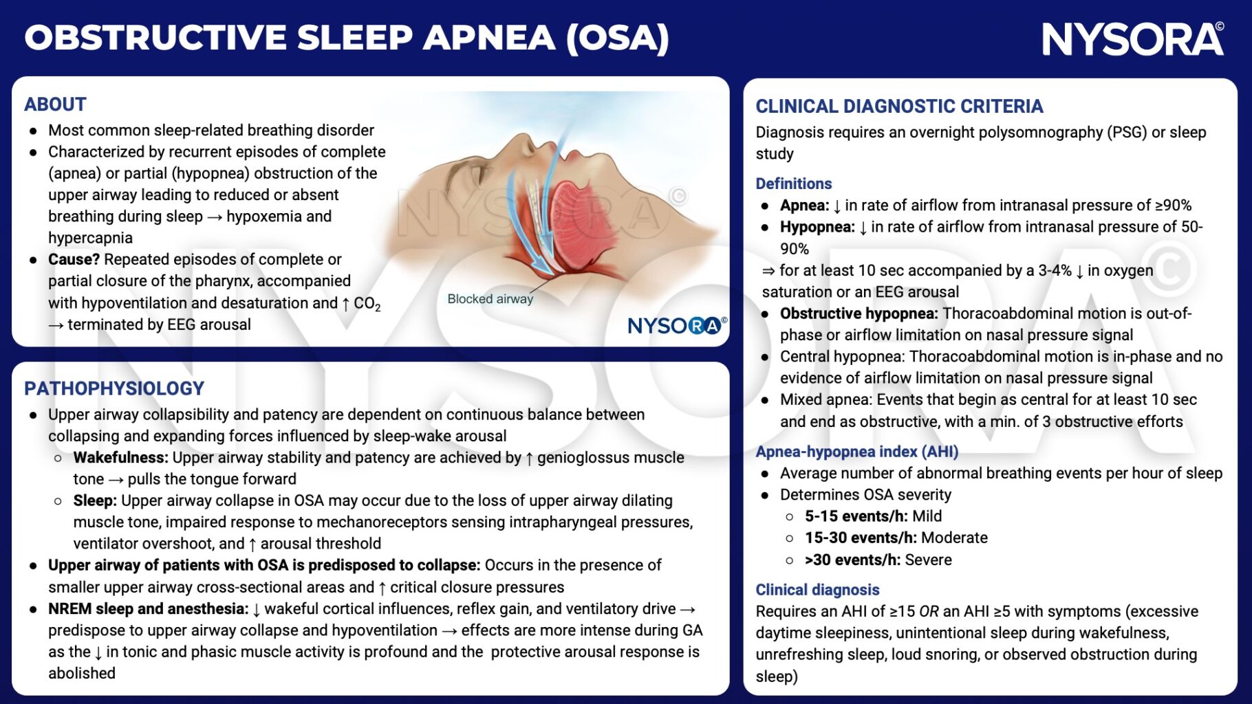 Obstructive Sleep Apnea Nysora