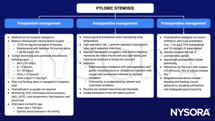 Pyloric stenosis - NYSORA