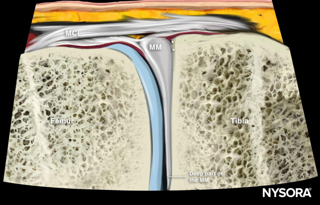 Tips for scanning the medial meniscus in a longitudinal orientation ...