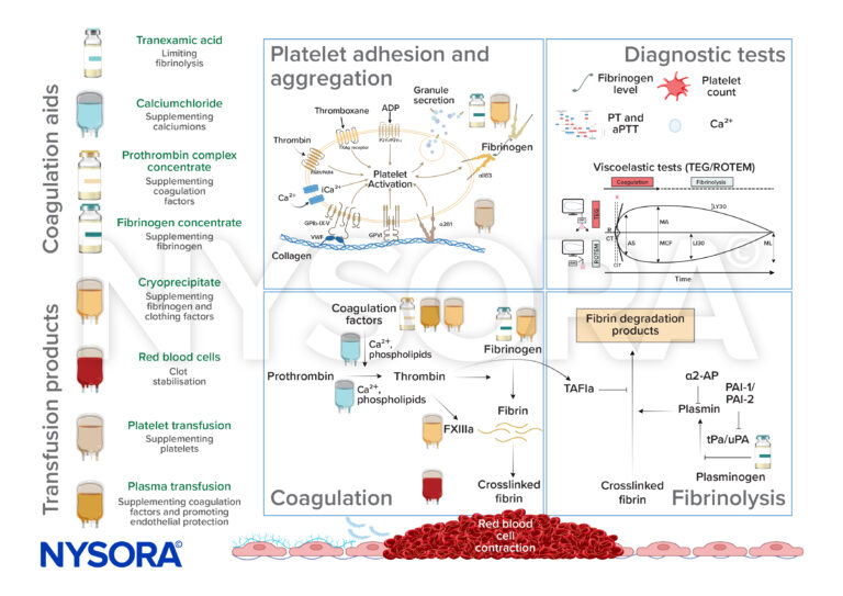 Perioperative bleeding - NYSORA