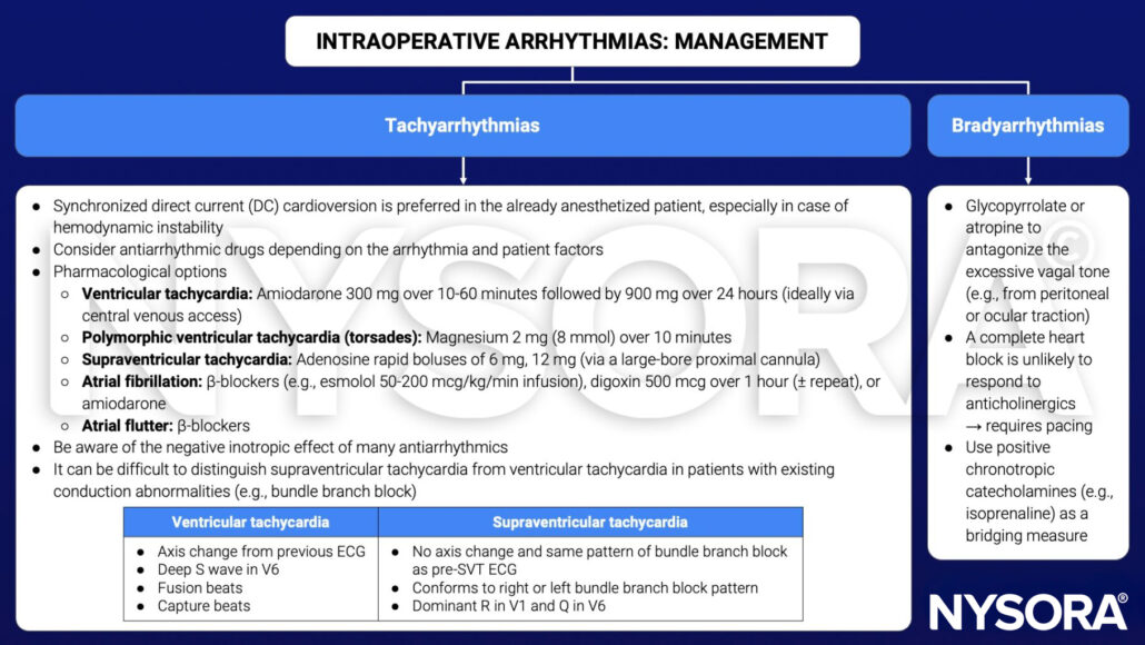 Intraoperative arrhythmias - NYSORA
