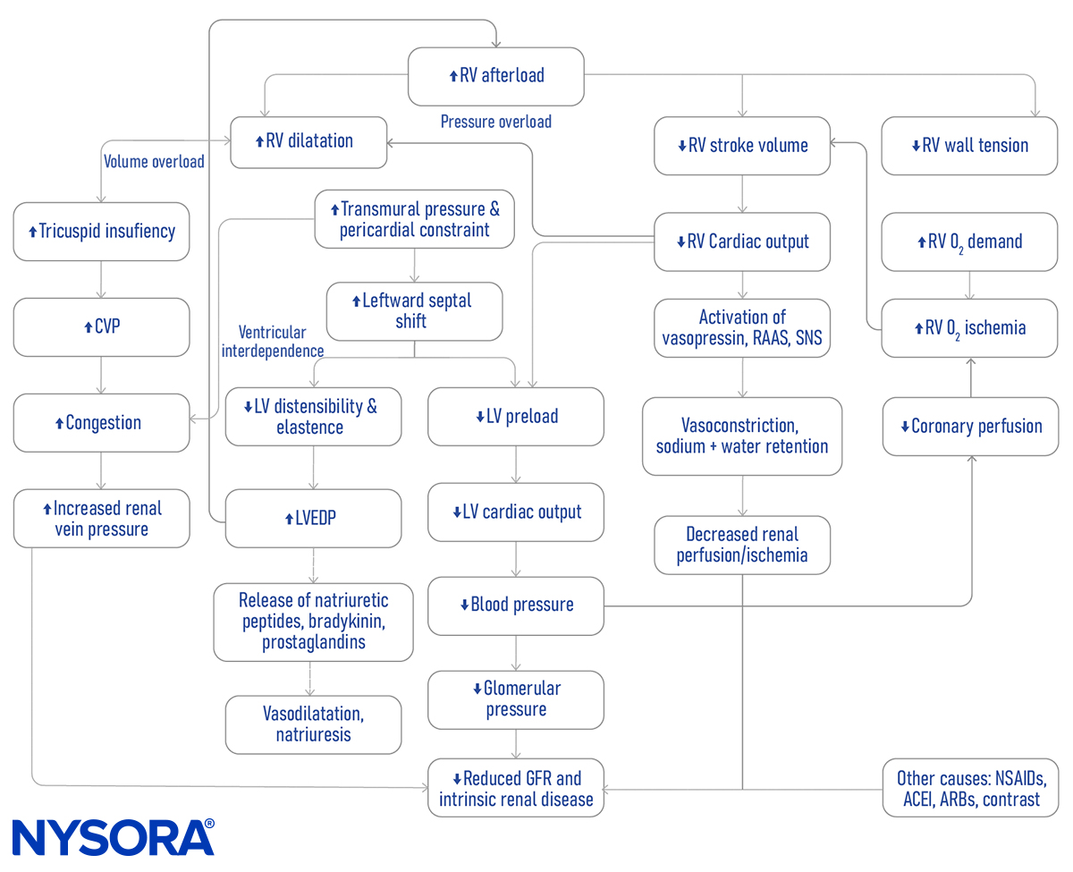 Right heart failure - NYSORA