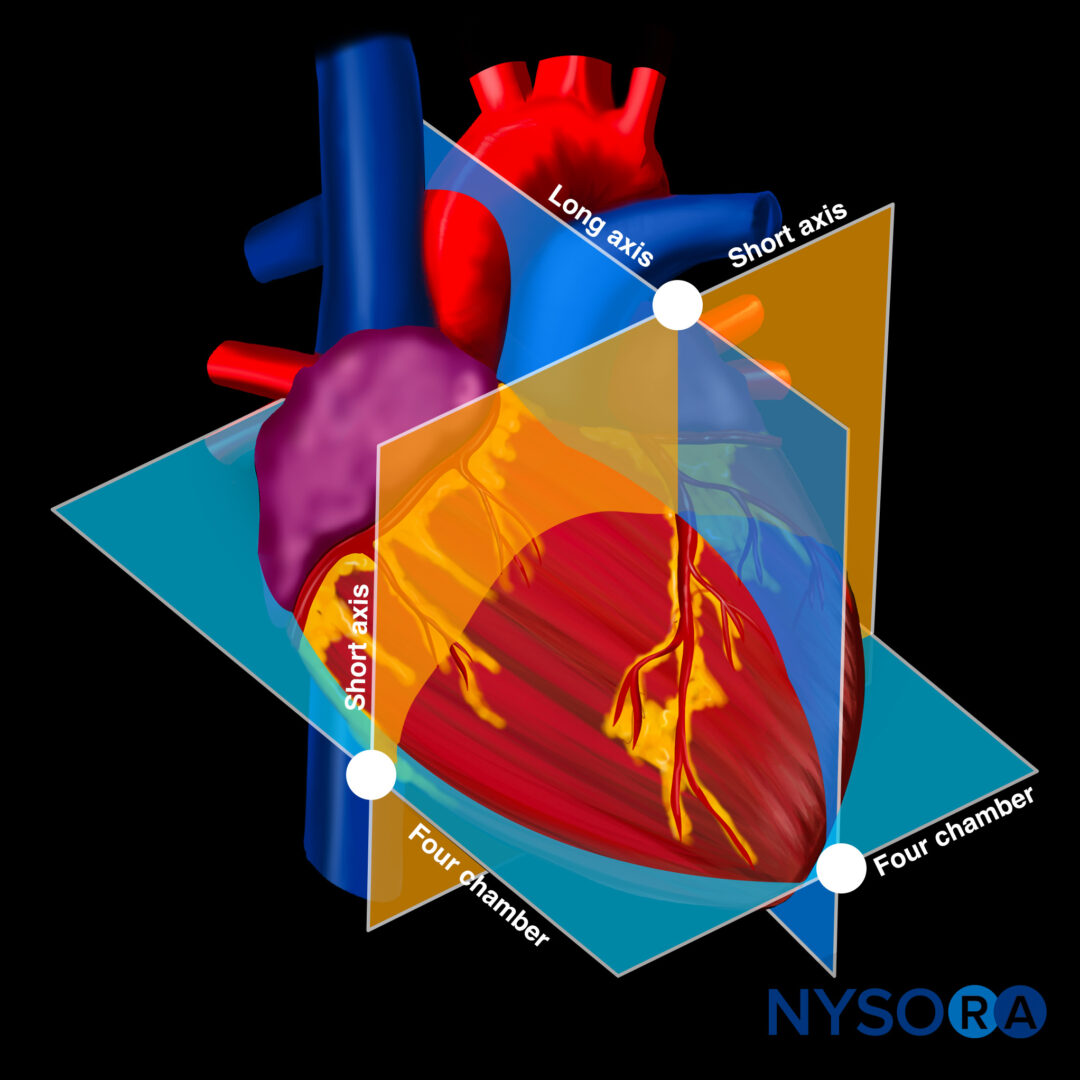 heart illustration PLANES 2 (1) - NYSORA