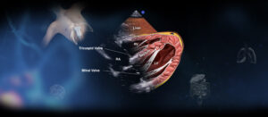 copertina di pocus - NYSORA