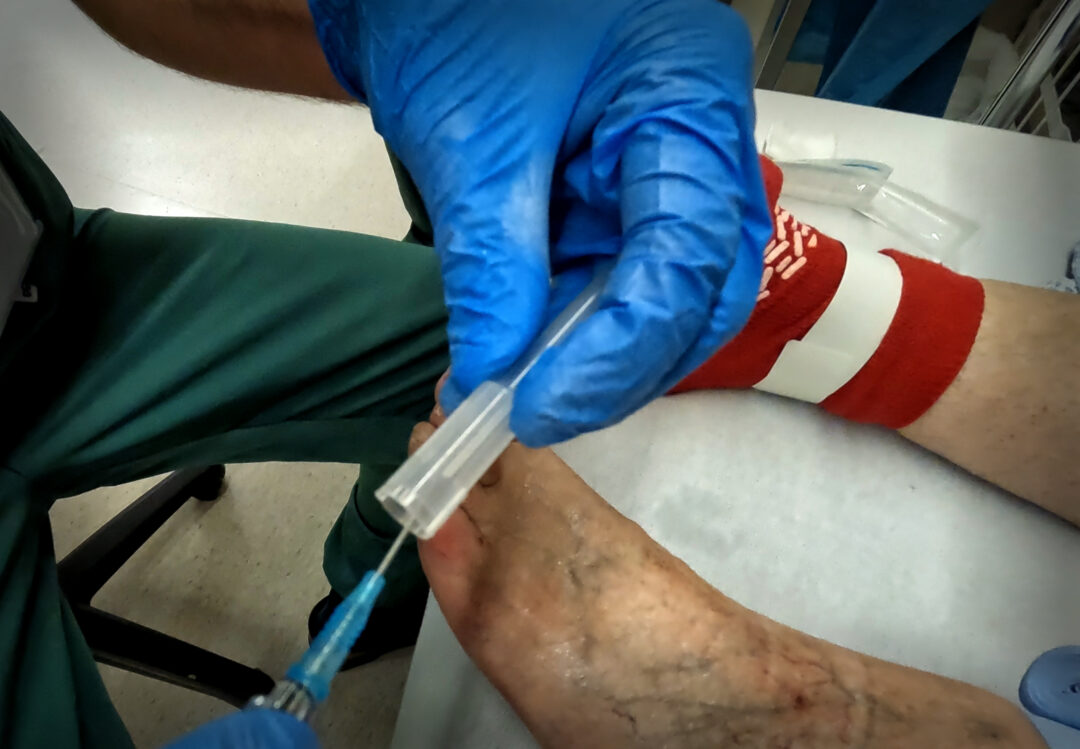 Difficult IV: 5 Tips To Know - NYSORA