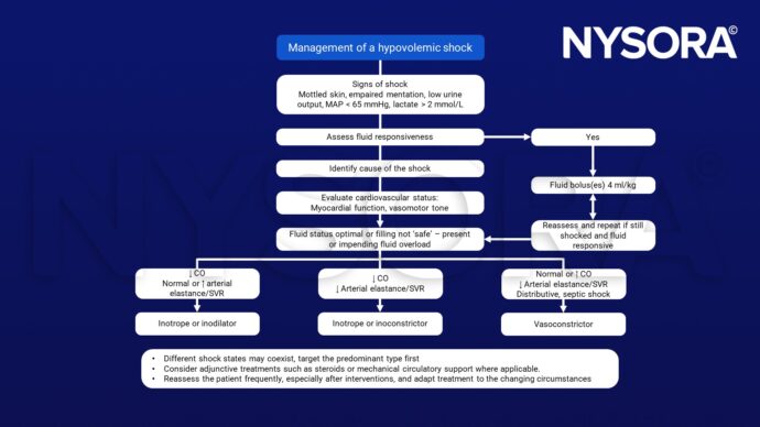 Hypovolemia - NYSORA