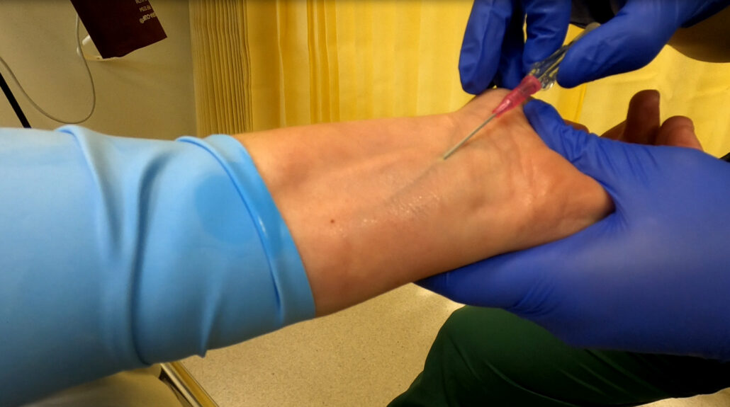 Difficult IV: 5 Tips To Know - NYSORA