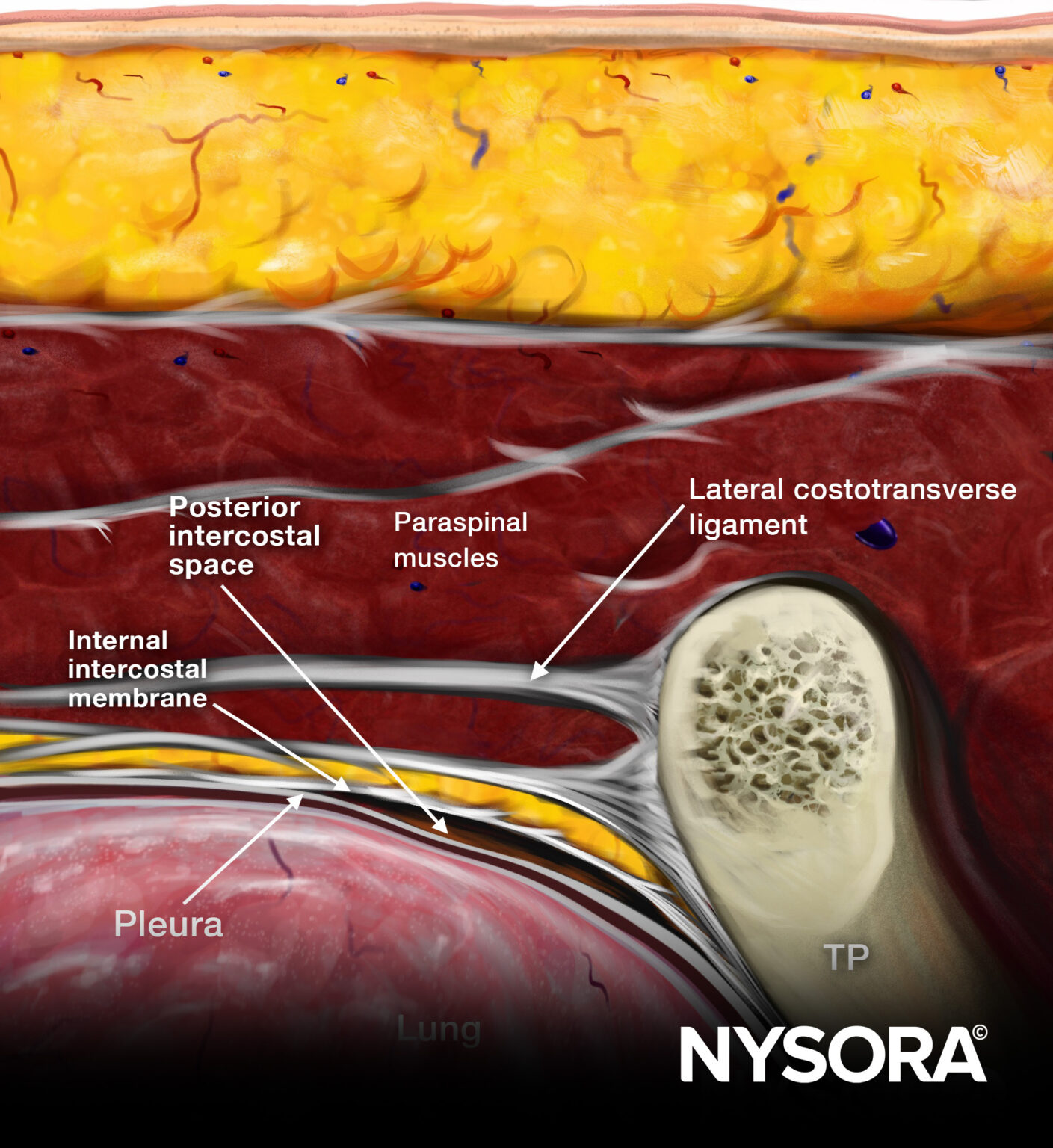 Tips for the Thoracic Paravertebral Block (Transverse Scan) - NYSORA