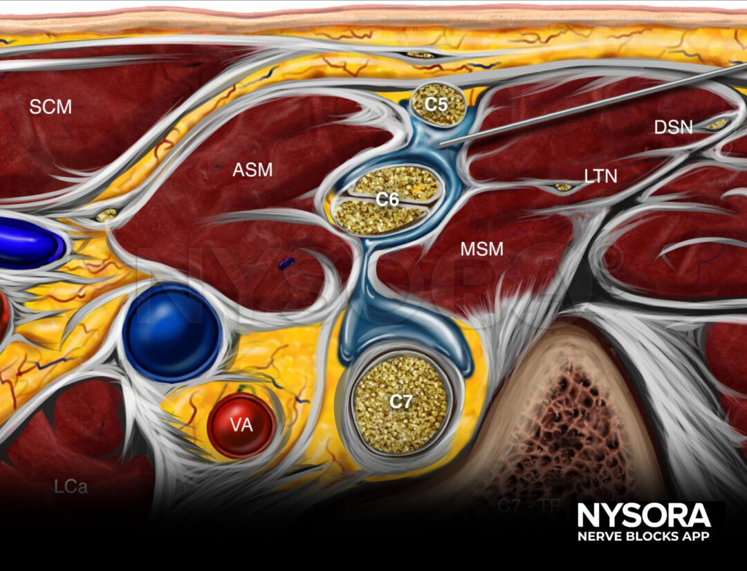 image3 - NYSORA | NYSORA