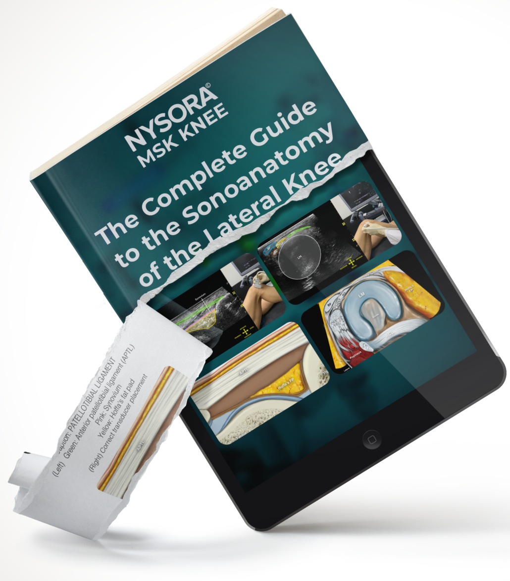 02 - NYSORA | NYSORA