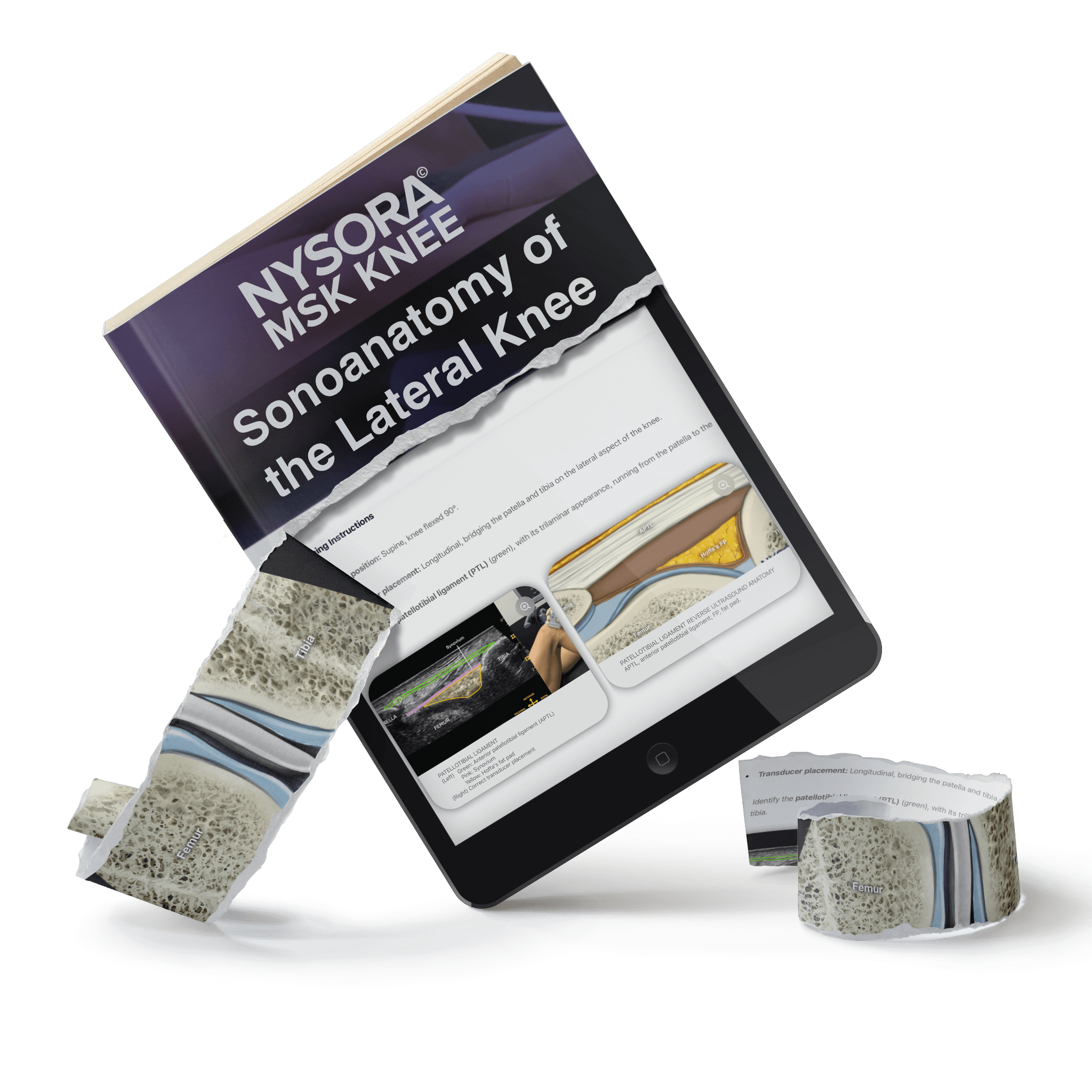 02 copy-2-2 - NYSORA | NYSORA