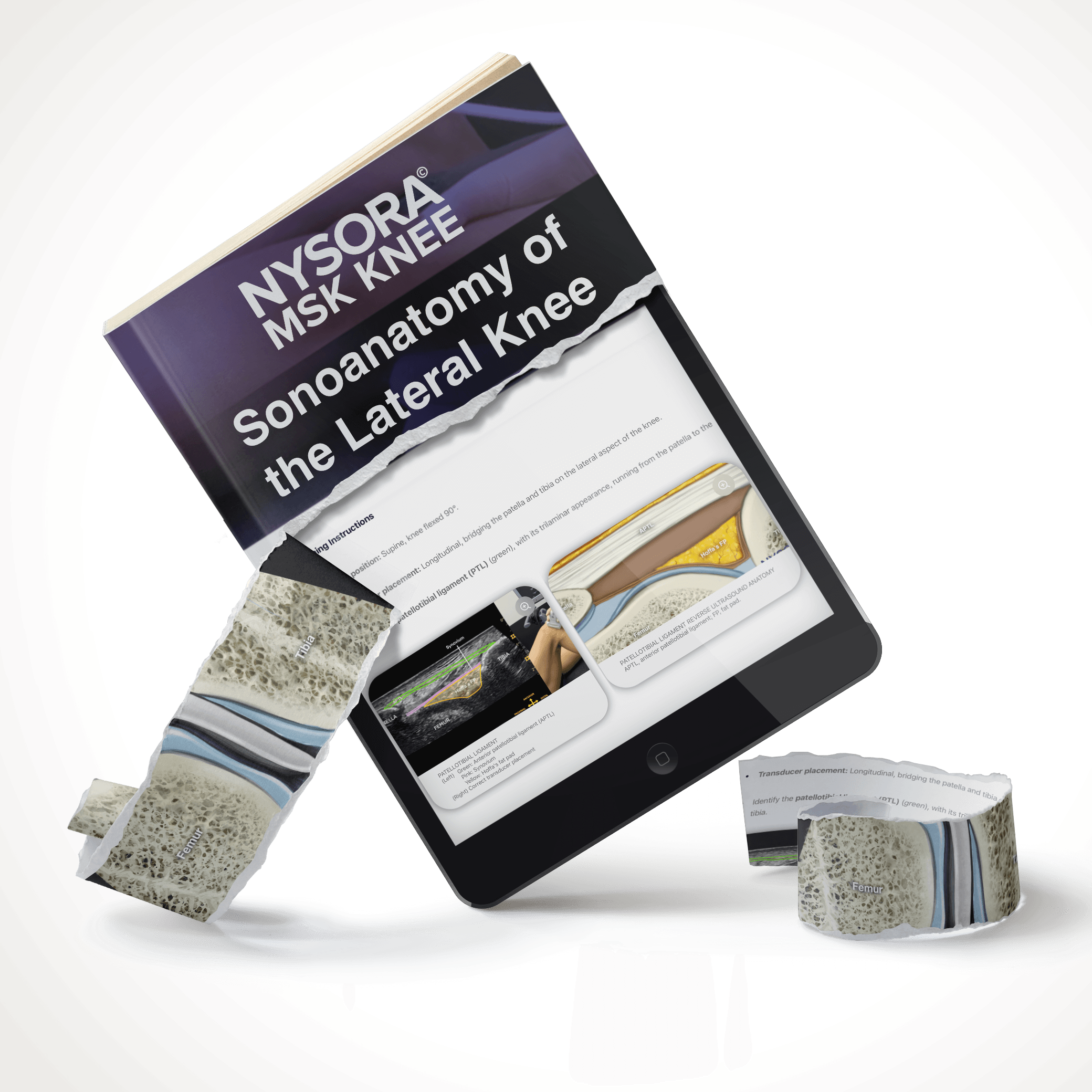 02 copy-2 - NYSORA | NYSORA