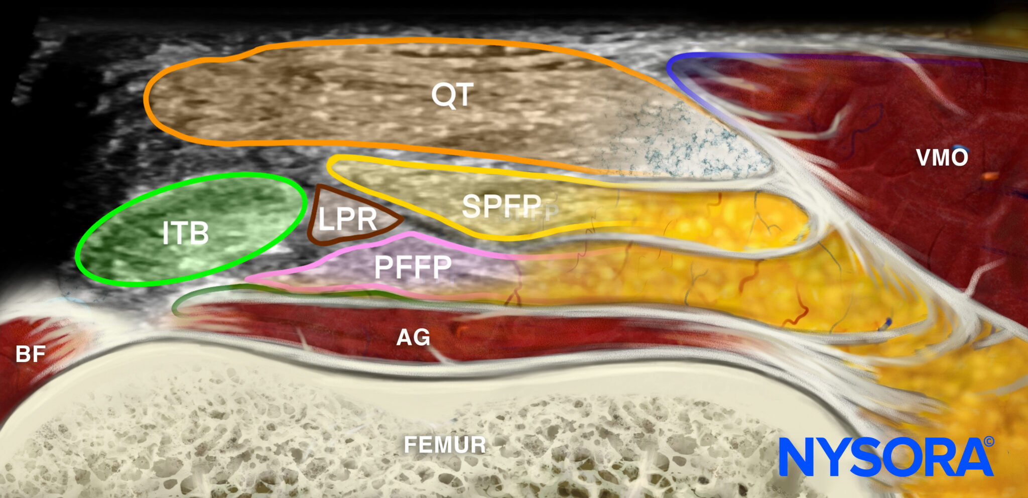 MSK Ultrasound of the Knee at Its Best - NYSORA