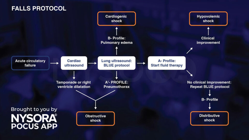急性循環不全: FALLS プロトコル - NYSORA