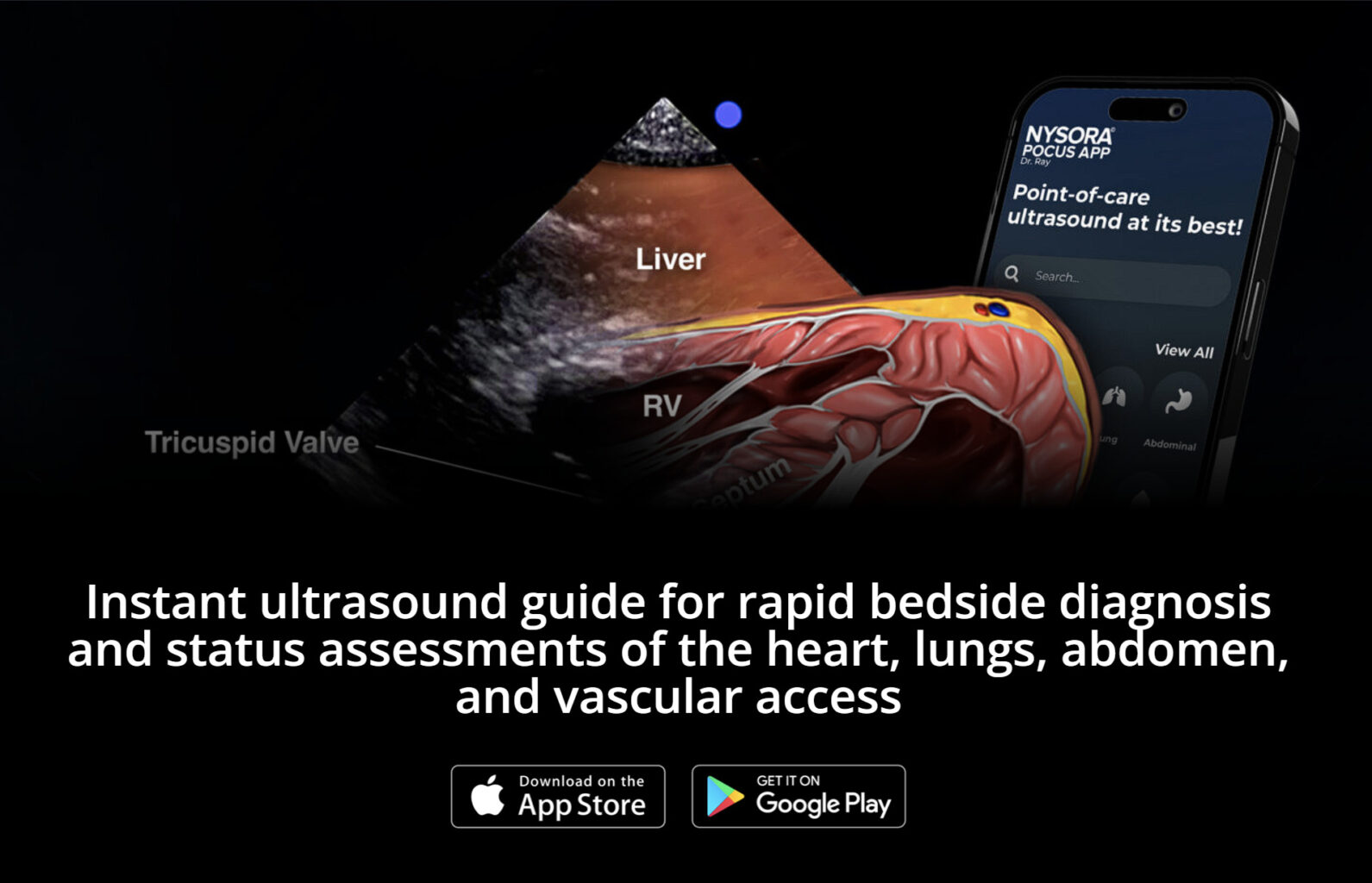 Assessing Cerebral Vasospasm with Transcranial Doppler: A Step-by-Step ...
