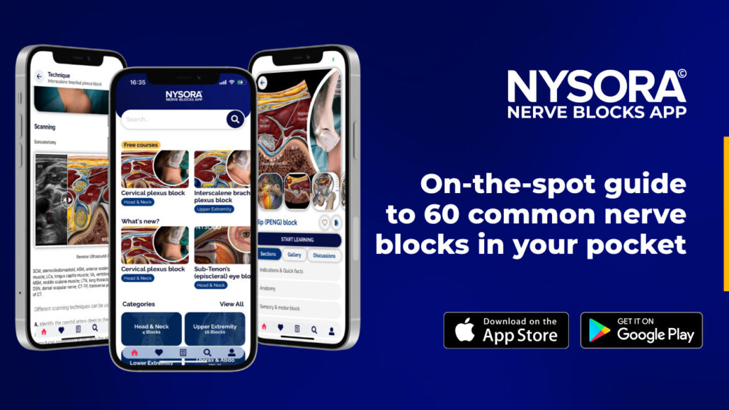 Case study: Achilles tendon repair - NYSORA