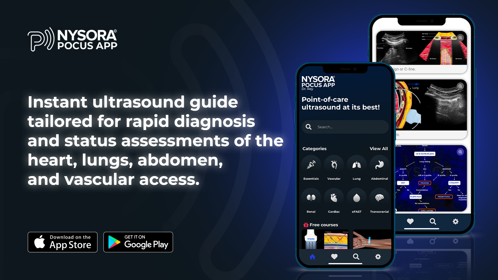 New POCUS course: Abdominal aortic aneurysm (AAA) - NYSORA