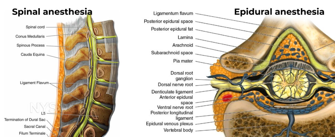 NYSORA Regional Anesthesia Manual e-Course
