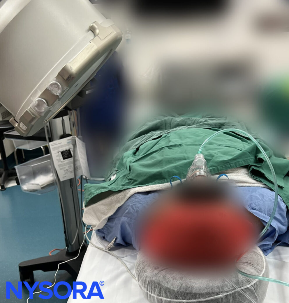 Case study: Upper limb complex regional pain syndrome (CRPS) - NYSORA