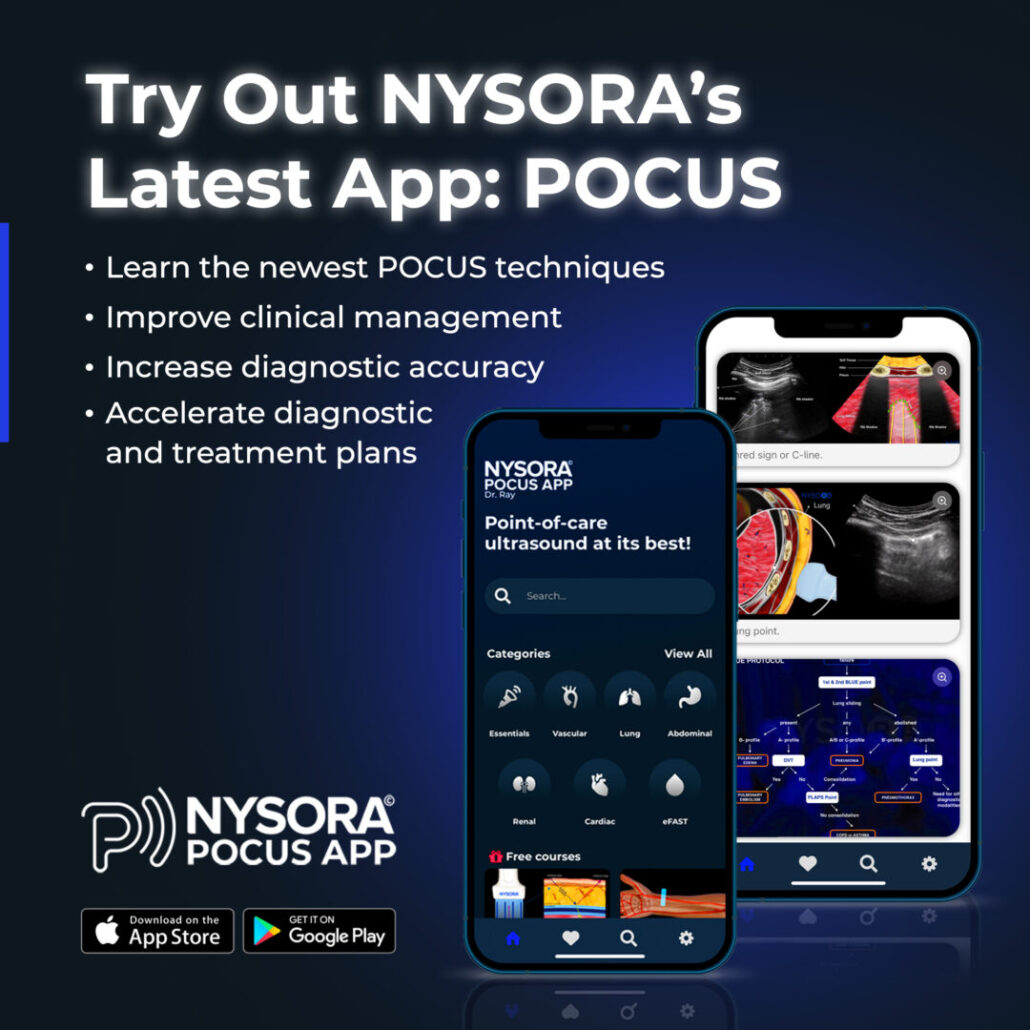 Assessing Fluid Status in the ICU: The Role of POCUS - NYSORA