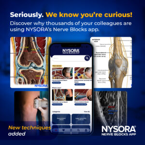 Tips for a Femoral Nerve Block - NYSORA