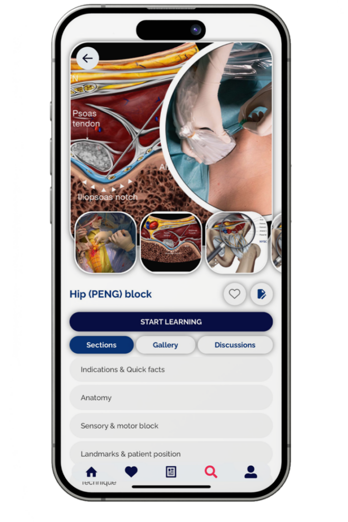 NYSORA Nerve Blocks App - new design - Ultrasound Guided Nerve Blocks