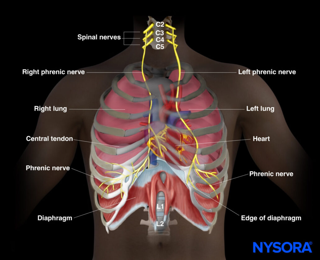 Case study: Monitoring phrenic nerve paresis with POCUS after regional ...