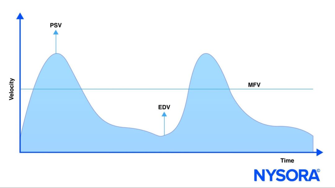 Case study: Detecting intracranial hypertension using transcranial ...