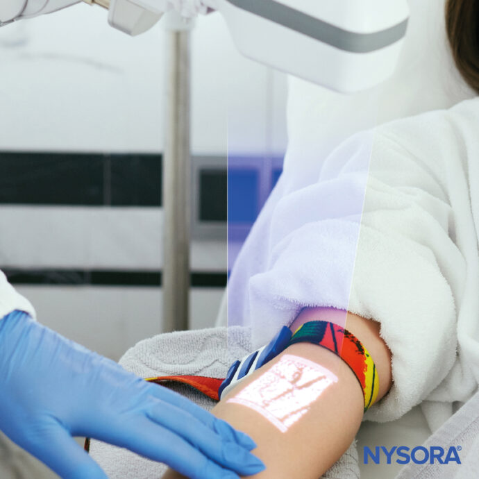 Finding the perfect vein: Tips for selecting the ideal site for IV ...