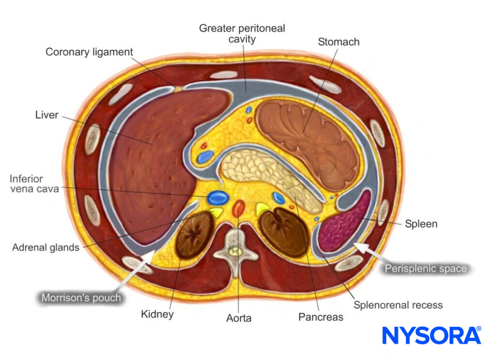 eFAST: A valuable tool in trauma diagnosis - NYSORA