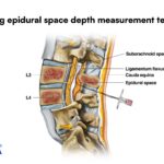 Ultrasound-Guided Saphenous (Adductor Canal) Nerve Block - NYSORA