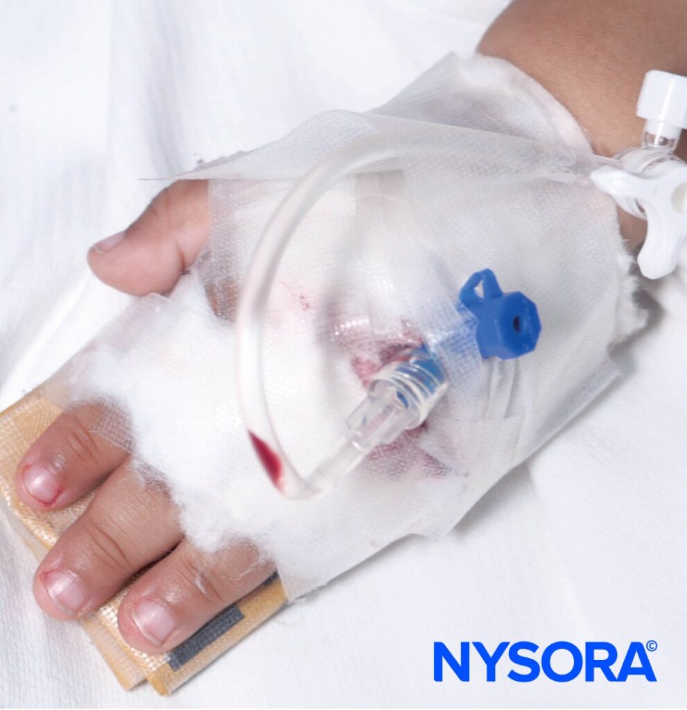 Preparation - NYSORA
