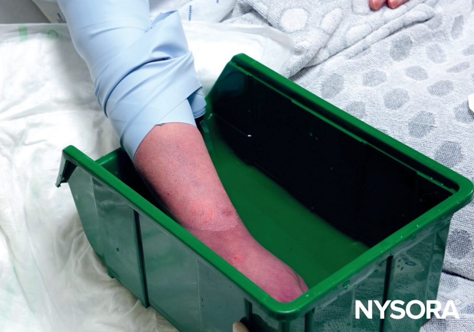 Cannulating complex veins - NYSORA