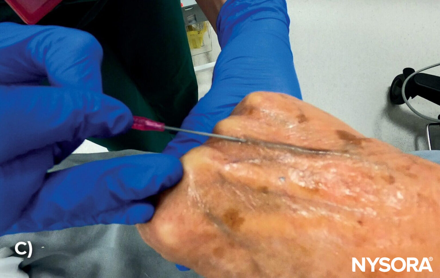 IV access in elderly patients - NYSORA