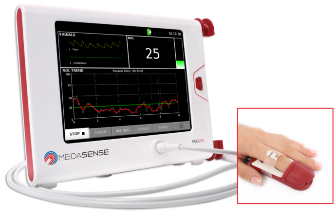 NOL – Nociception Level Index®: A New Era in Regional Anesthesia ...