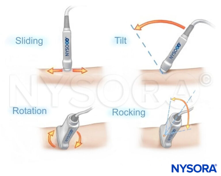 Essential cardiac ultrasound - NYSORA