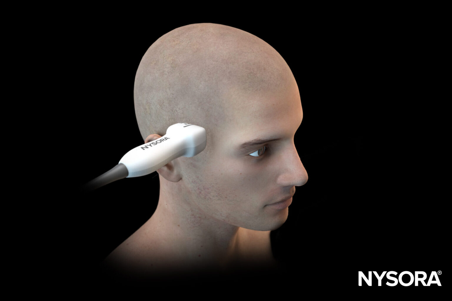 Midline shift - NYSORA
